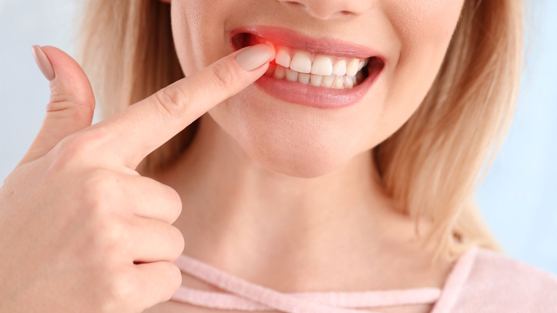 Le tasche gengivali dalla a alla zeta - Dott. Matteo Zappa - Medico Chirurgo